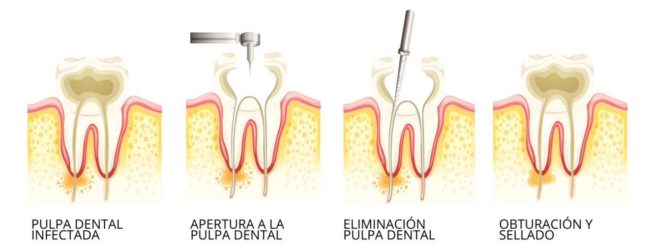 Autran Dental
